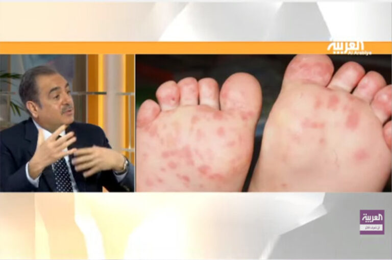 Learn to spot different kinds of skin rashes for baby