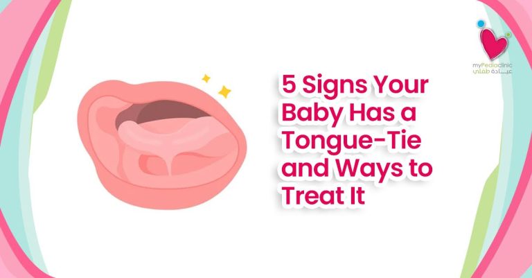 Is Your Baby Tongue-Tied? 5 Signs Every Parent Should Know